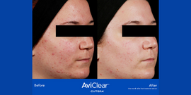 Before & After | Dr. Lincoln Roland | Vascular Surgeon Pensacola, FL